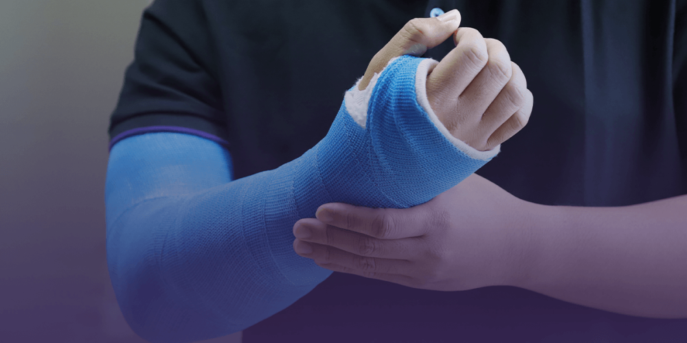 Can You Fly With A Cast? | Here's How Long You Need To Wait