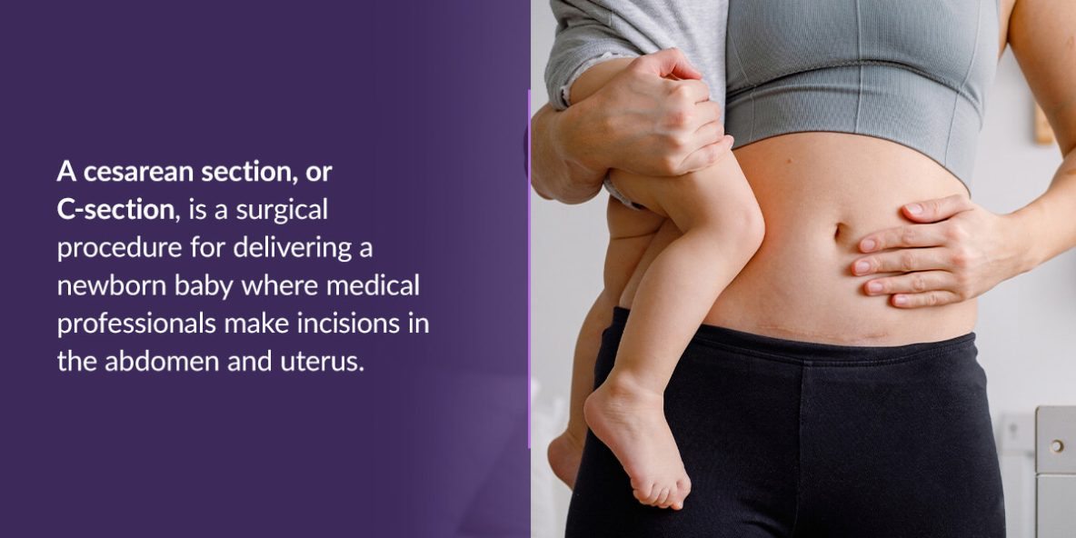 How Soon Can You Fly After A C Section? Fly REVA